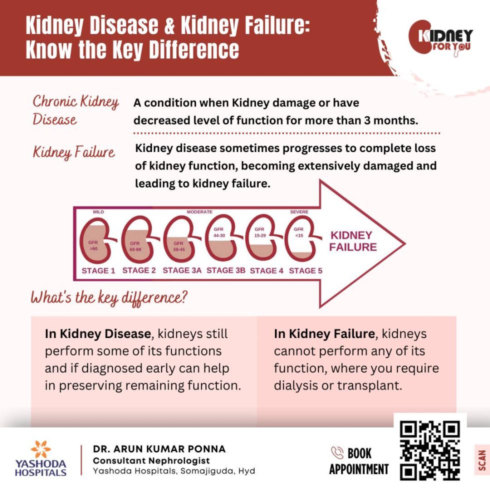 Key Differences between Kidney Disease and Kidney Failure